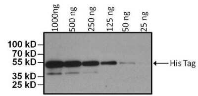His Tag Antibody (HIS.H8) [HRP] (NBP2-31055H): Novus Biologicals